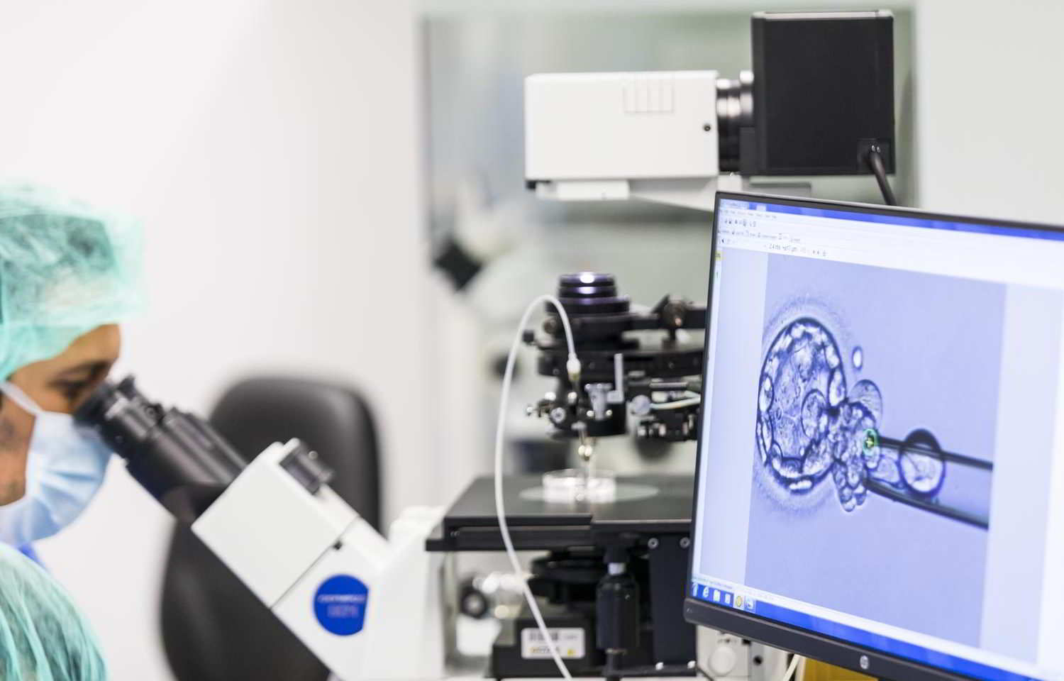 Quelles sont les causes de l'infertilité? - Cliniques IVI