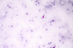 Qu’est-ce que l’anéjaculation ? Quelles sont les causes ? Quels sont ...